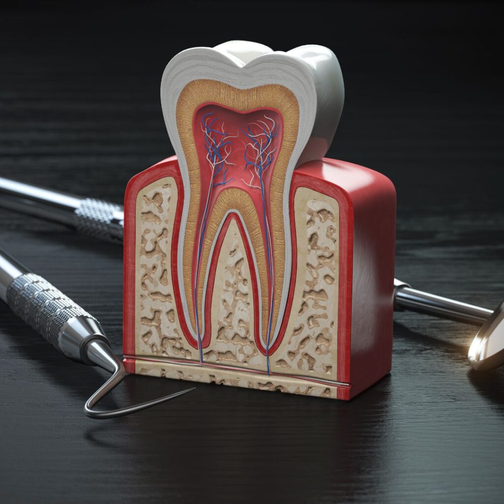 ¿Qué elimina un nervio del diente? - Dentalius